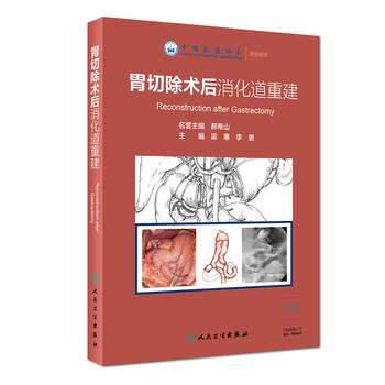 胃切除术后消化道重建