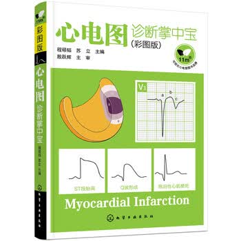 心电图诊断掌中宝（彩图版）（全彩图解）