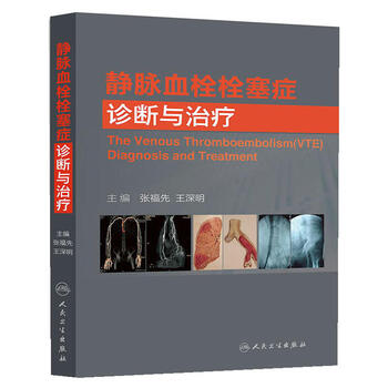 静脉血栓栓塞症诊断与治疗