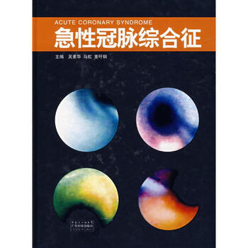 急性冠脉综合征