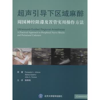 超声引导下区域麻醉
