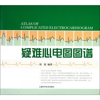疑难心电图图谱
