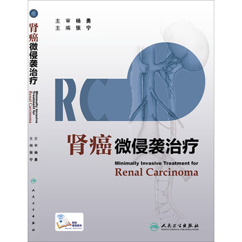 肾癌微侵袭治疗