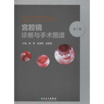宫腔镜诊断与手术图谱(第2版)