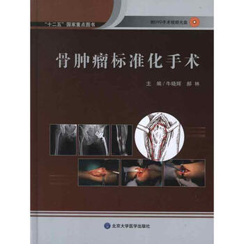 骨肿瘤标准化图谱