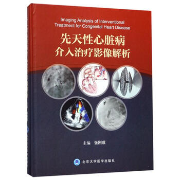先天性心脏病介入治疗影像解析