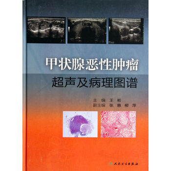 甲状腺恶性肿瘤超声及病理图谱(精)