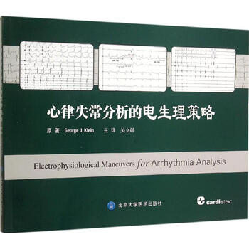 心律失常分析的电生理策略