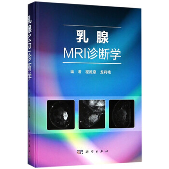 乳腺MRI诊断学(精)