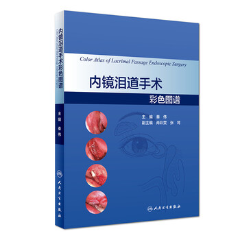 内镜泪道手术彩色图谱