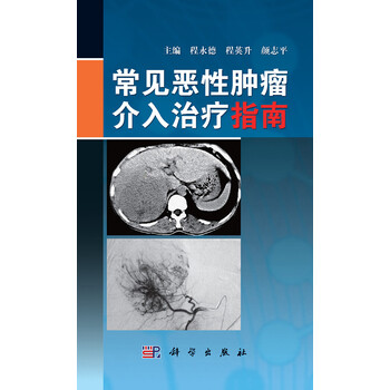 [按需印刷] 常见恶性肿瘤介入治疗指南