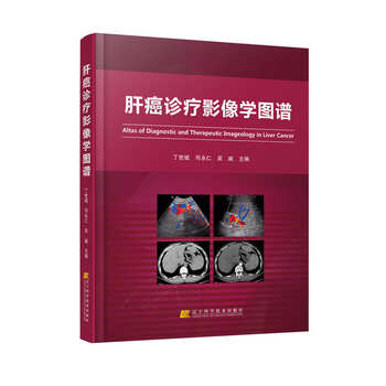 肝癌诊疗影像学图谱