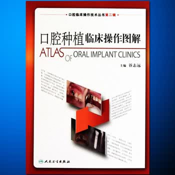 口腔种植临床操作图解