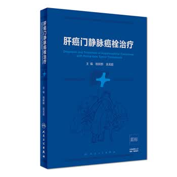 肝癌门静脉癌栓治疗