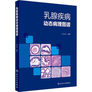 乳腺疾病动态病理图谱