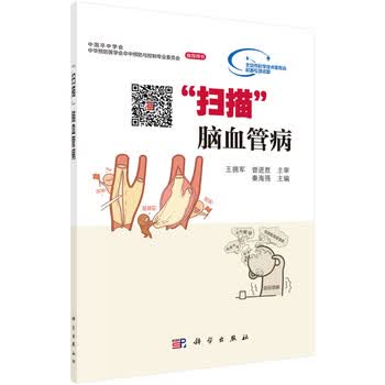 “扫描”脑血管病