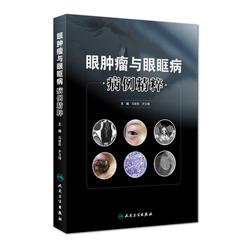 [正版图书]眼肿瘤与眼眶病病例精粹