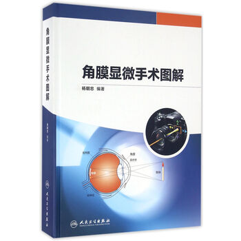 角膜显微手术图解（精）