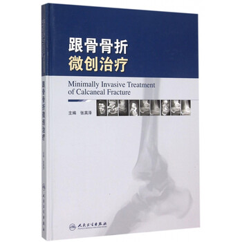 跟骨骨折微创治疗(精)