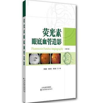 正版 荧光素眼底血管造影(修订本)9787543334410