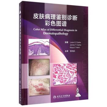 皮肤病理鉴别诊断彩色图谱(精)