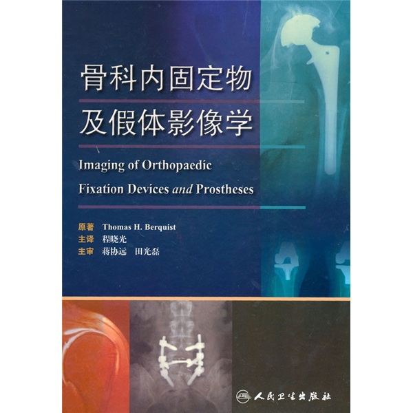 骨科内固定物及假体影像学