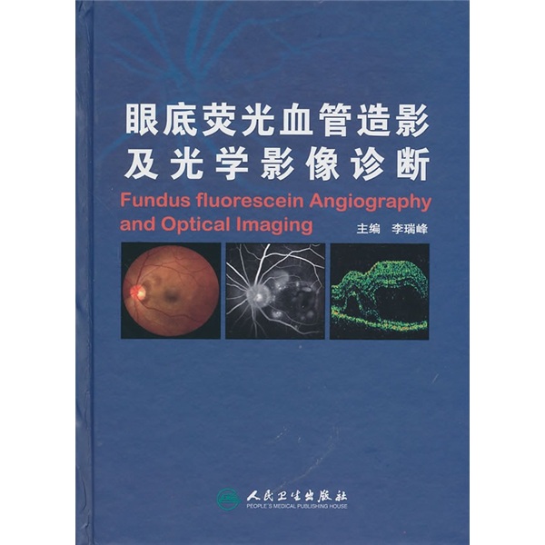 眼底荧光血管造影及光学影像诊断