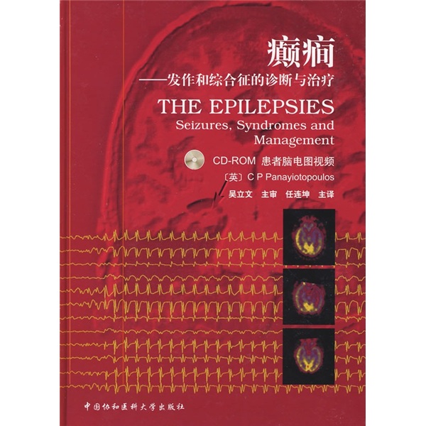 癫囗：发作和综合征的诊断与治疗（附光盘）
