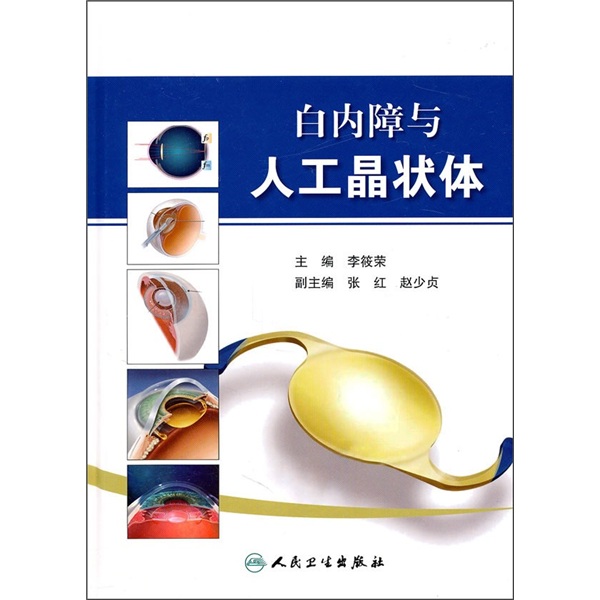 白内障与人工晶状体