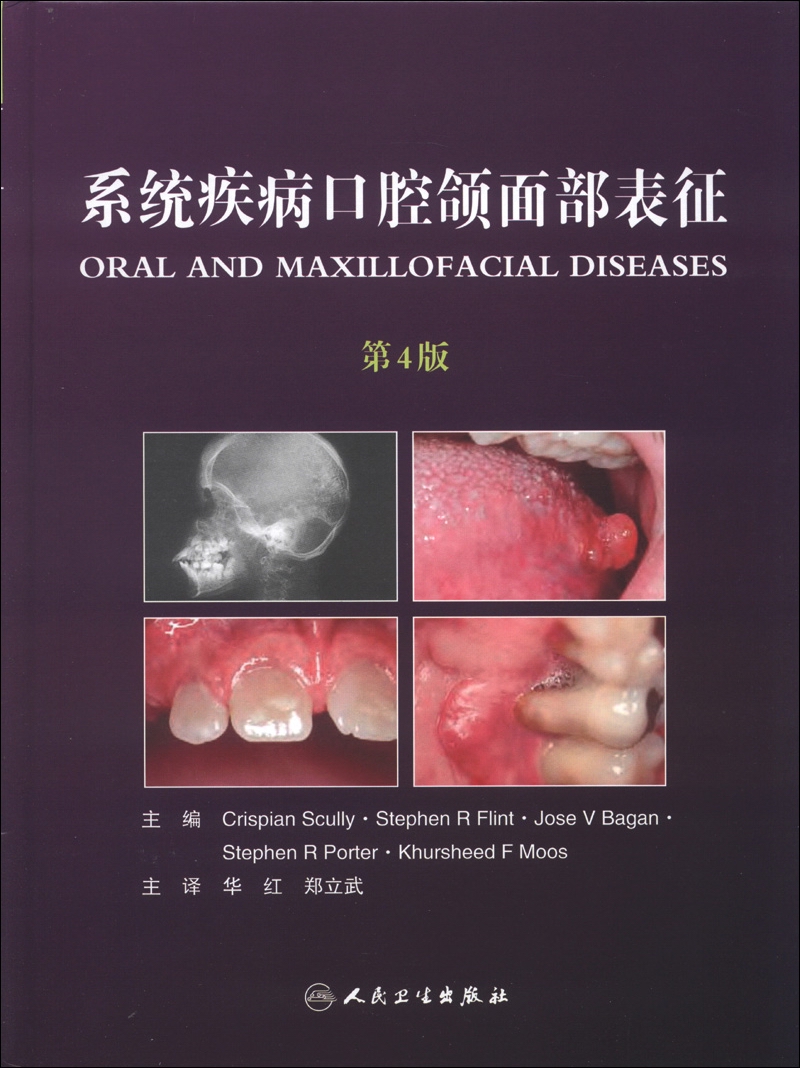 系统疾病口腔颌面部表征-第4版9787117161404