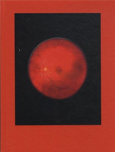 Mikhael Subotzky: Retinal Shift[苏博斯基: 视网膜转变]