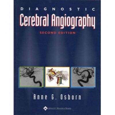 Diagnostic Cerebral Angiography
