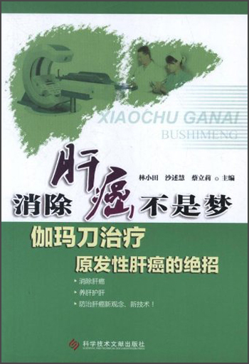 消除肝癌不是梦：伽玛刀治疗原发性肝癌的绝招