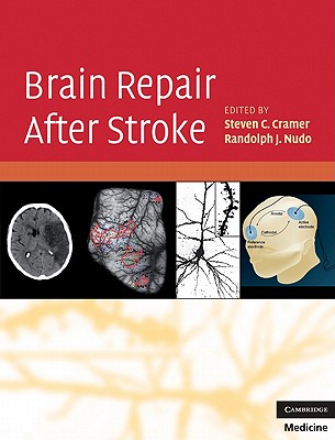 Brain Repair After Stroke