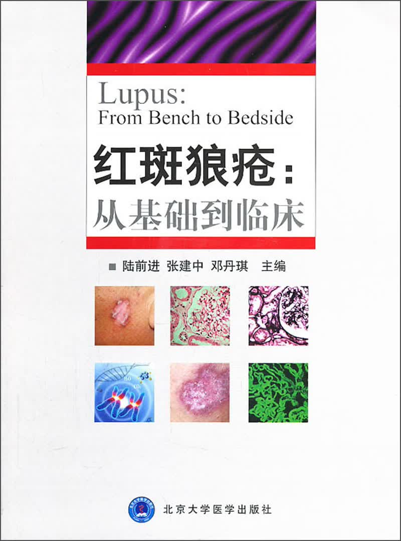 红斑狼疮：从基础到临床