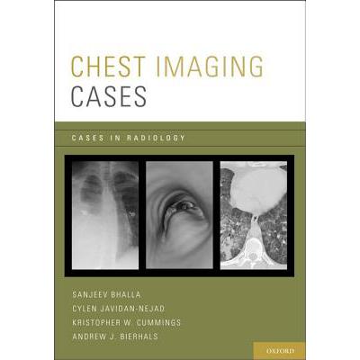 Chest Imaging Cases