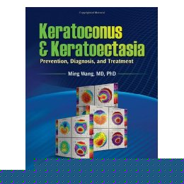 Keratoconus and Keratoectasia: