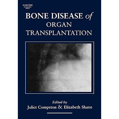 Bone Disease of Organ Transplantation