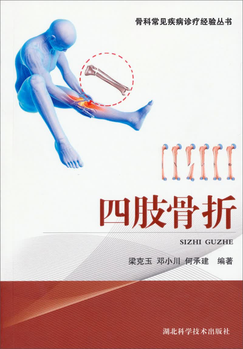 骨科常见病疹疗经验丛书：四肢骨折