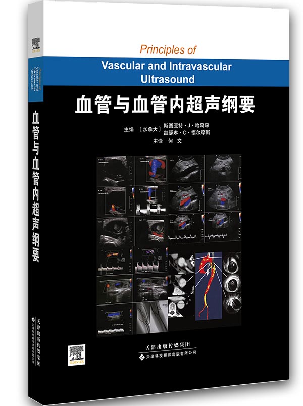 血管与血管内超声纲要（国外引进）（中文翻译）