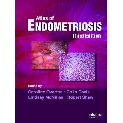 An Atlas of Endometriosis