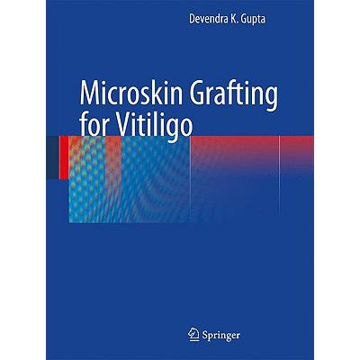 Microskin Grafting for Vitiligo