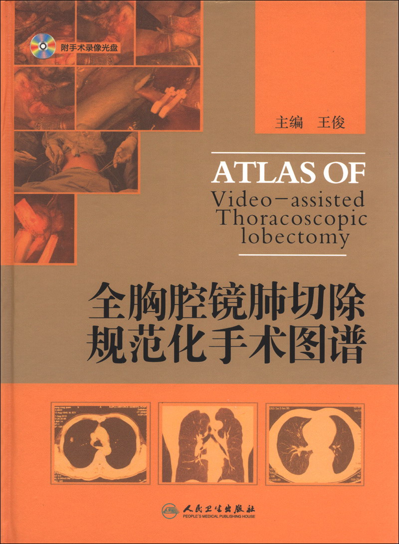 全胸腔镜肺切除规范化手术图谱（附DVD-ROM光盘1张）
