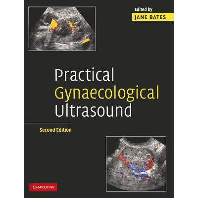 Practical Gynaecological Ultrasound