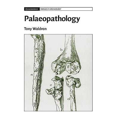 Palaeopathology: - Palaeopathology