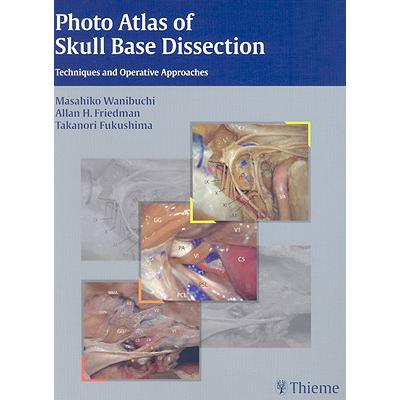 Photo Atlas of Skull Base Dissection: Techniques and Operative Approaches