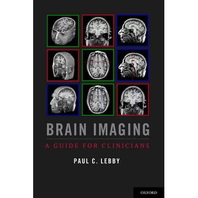 Brain Imaging: A Guide for Clinicians