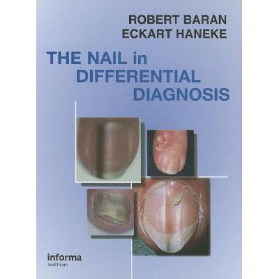 The Nail in Differential Diagnosis