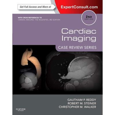 Cardiac Imaging: Case Review Series