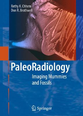 Paleoradiology: Imaging Mummies and